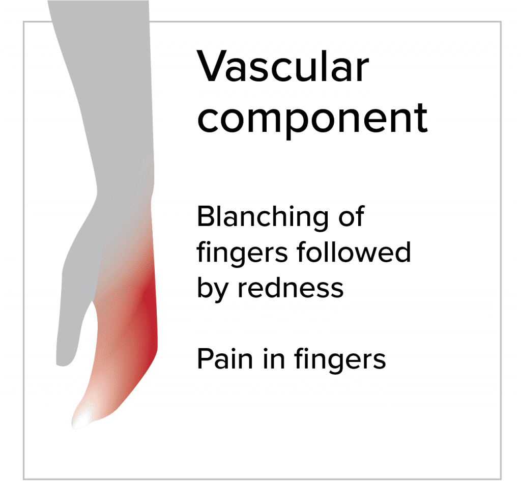 Vibration Injuries | Oakwood Solicitors Ltd - Leeds Law Firm