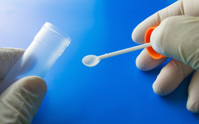 Stool Sample Diagnosis For Pancreatic Cancer - Oakwood Solicitors Ltd